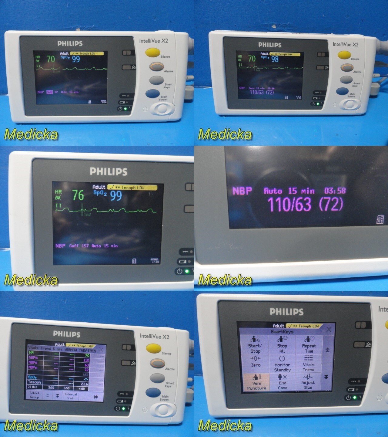 Philips M3002A Intellivue X2 Transport Monitor/MMS Module W/ 5X Leads ...