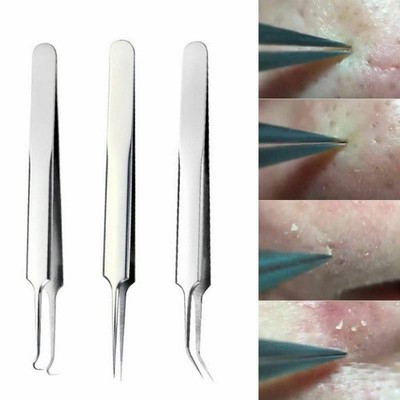 Blackhead Pimple Acne Comedone Extractor Clip Tweezers Whitehead ...