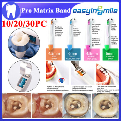 10/20/30Pcs Dental Pro Matrix Bands Metal Pre Formed Curved Bands For ...
