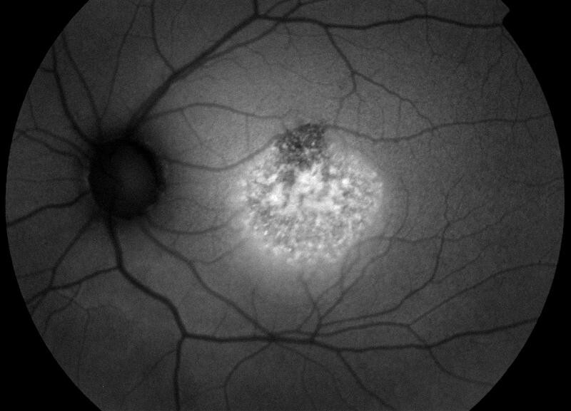 Topcon TRC-50DX ICG Retinal Camera with Imagenet 5 Color/Red-Free/FA ...