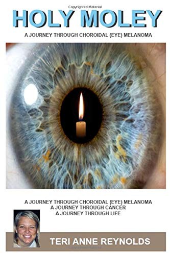 HOLY MOLEY: A JOURNEY THROUGH CHOROIDAL (EYE) MELANOMA By Teri Anne ...