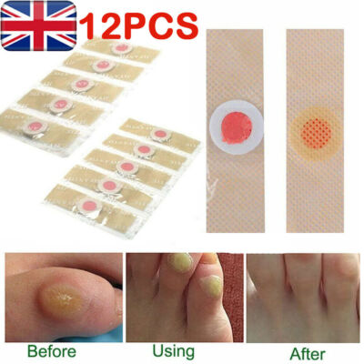 12pcs Corn Removal Patch Toe Callus Corn Remover Pads Wart Treatment ...