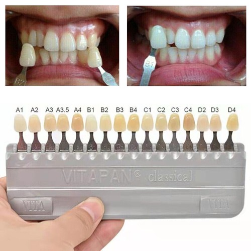 VITAPAN Classical Shade Guide Dental Materials A1-D4 16 Colors Teeth ...