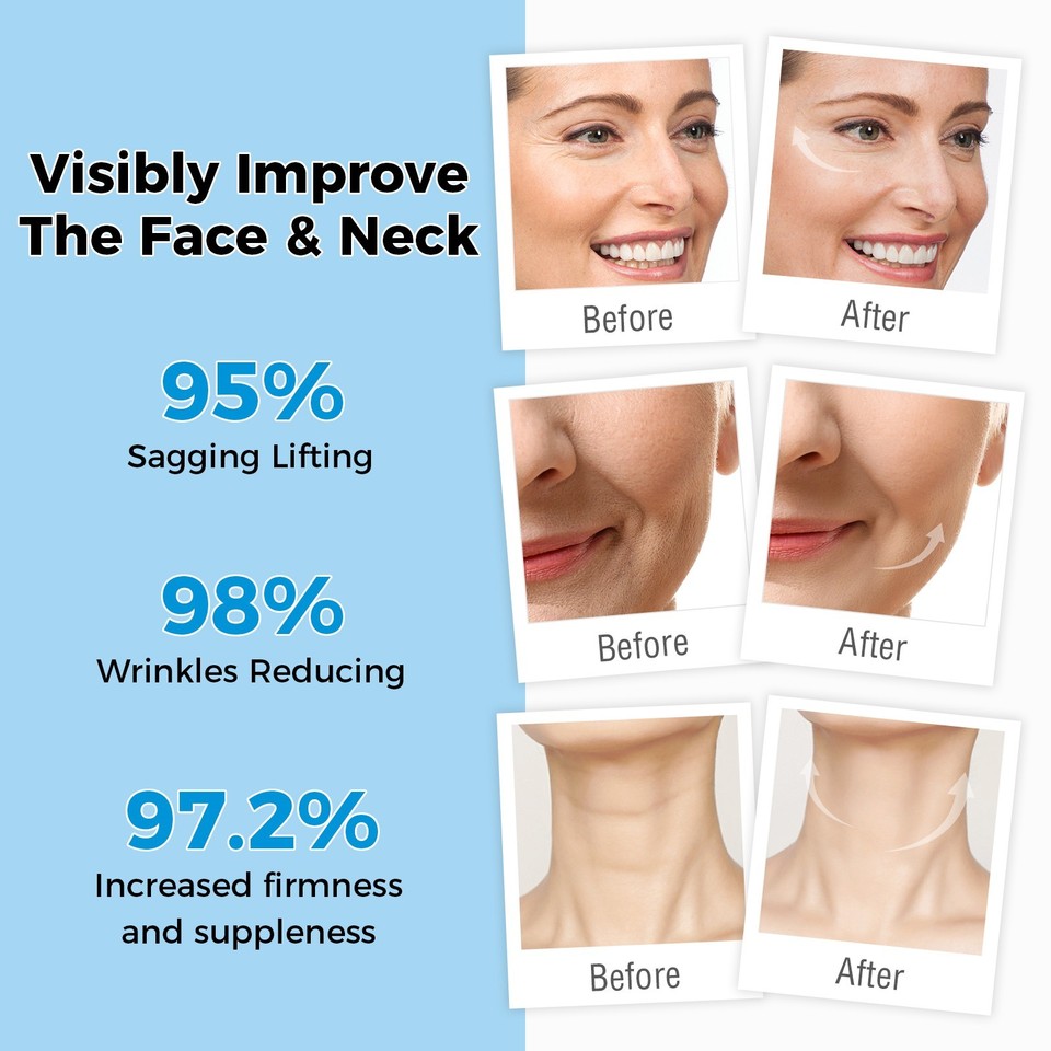 OUKEYA Retinol Face & Neck Cream Moisturiser Anti Ageing Wrinkle ...