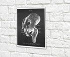 Anatomy Decor Poster set of 3 Unframed Posters Hip Knee Ankle Joints ...
