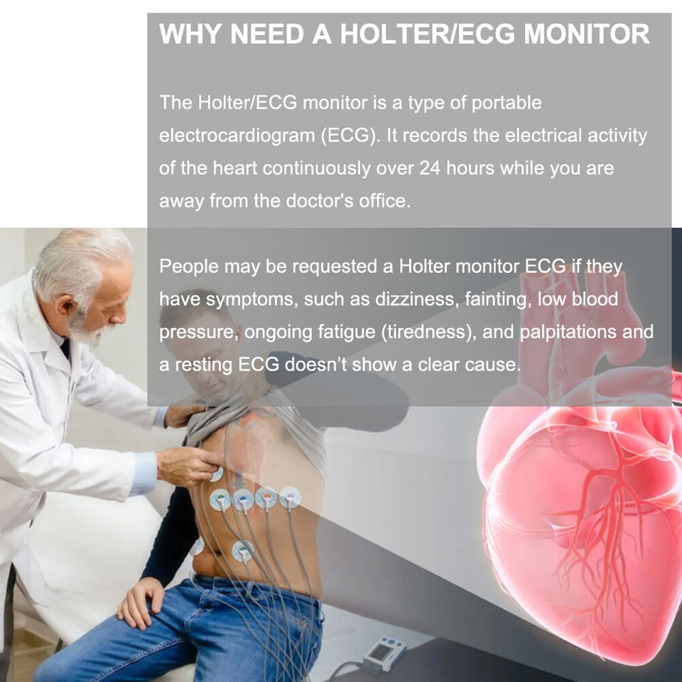 12 Lead Holter Monitor Recording 24h ECG and Heart Rate AI Analysis ...