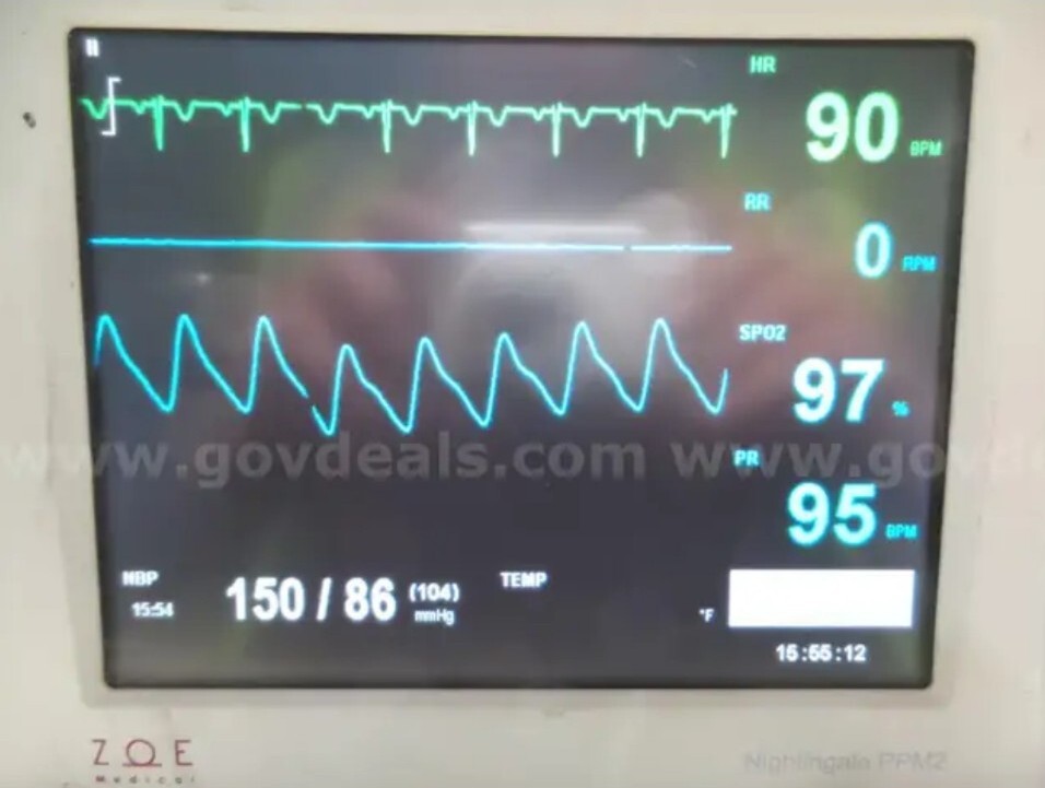 Zoe Medical Nightingale PPM2 Monitor 179-0001 | eBay