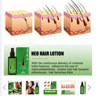 Neo Hair Lotion Hair Root Treatment Original Nutrients Longer Hair ...