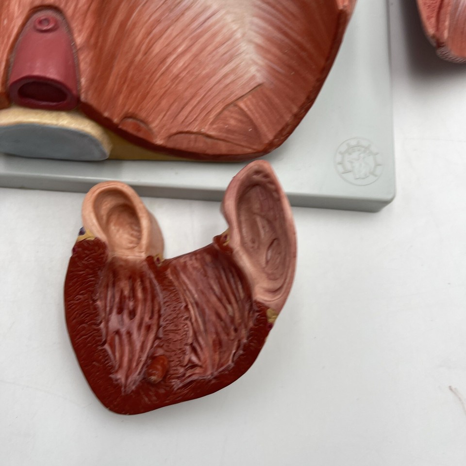 Somso HS7 Lungs with Heart, Diaphragm and Larynx Anatomical Model HS 7 ...
