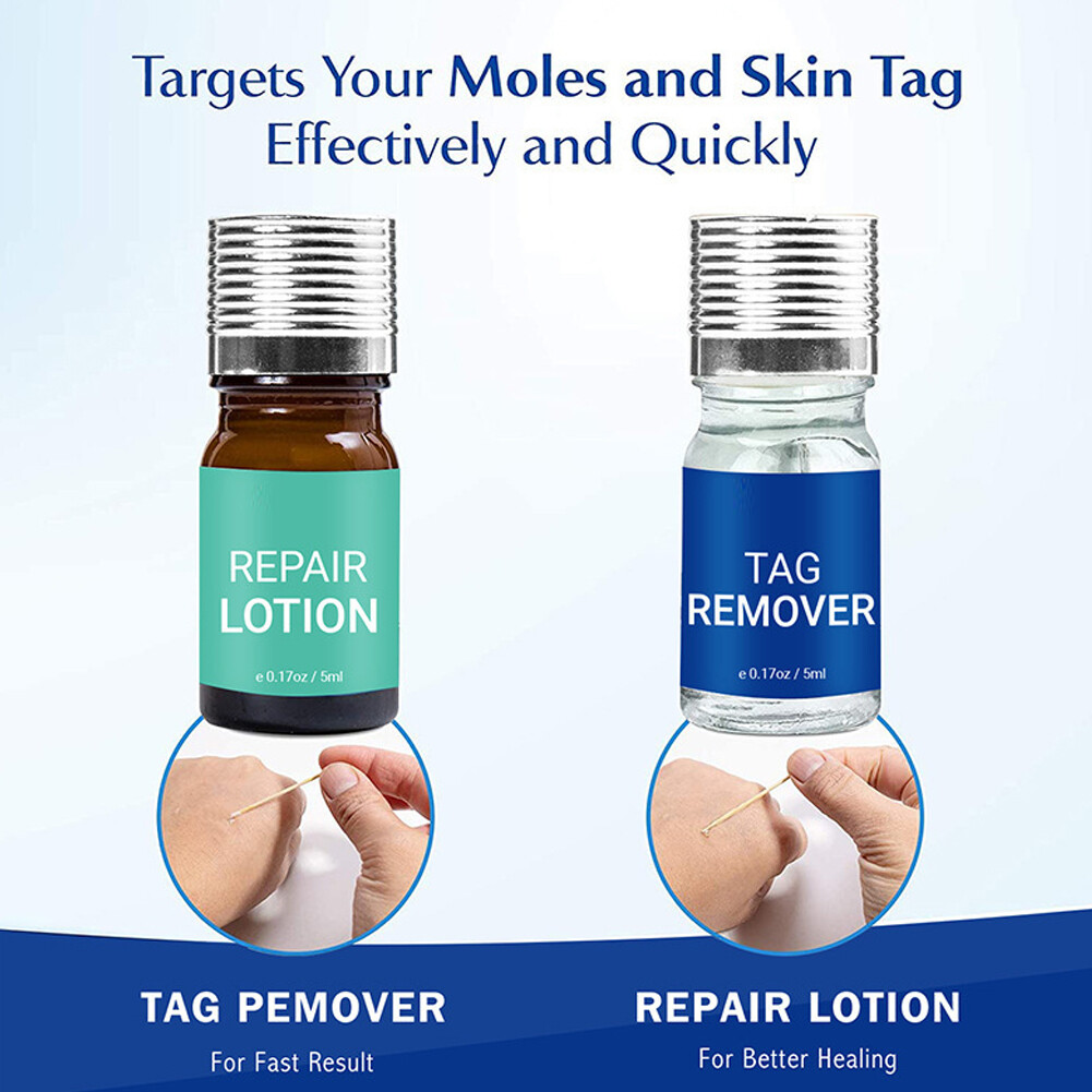 US 1-2 Pack Skin Tag Remover Repair Lotion Mole Corrector Wart Skin ...
