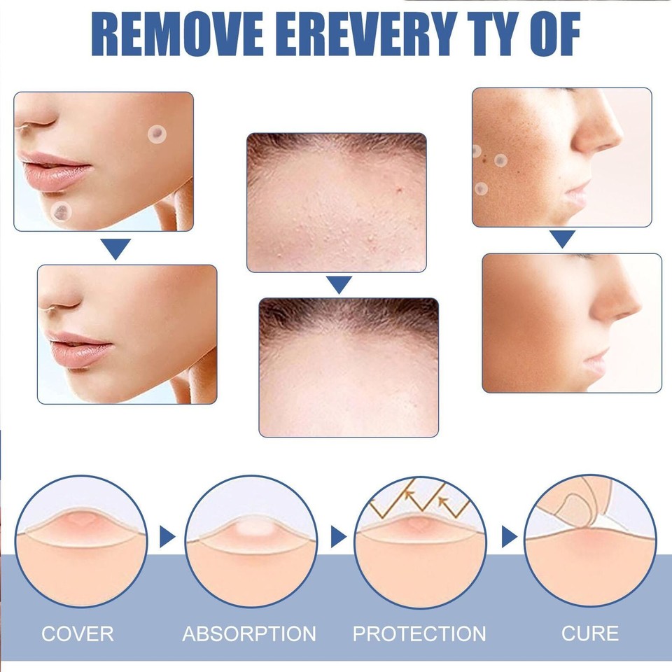 288pcs Skin Tag Remover Patches Quick Effective Mole Wart Removal Pad ...