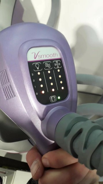 Syneron Candela Velashape II Adeline V Machines Vsmooth Applicator Big ...
