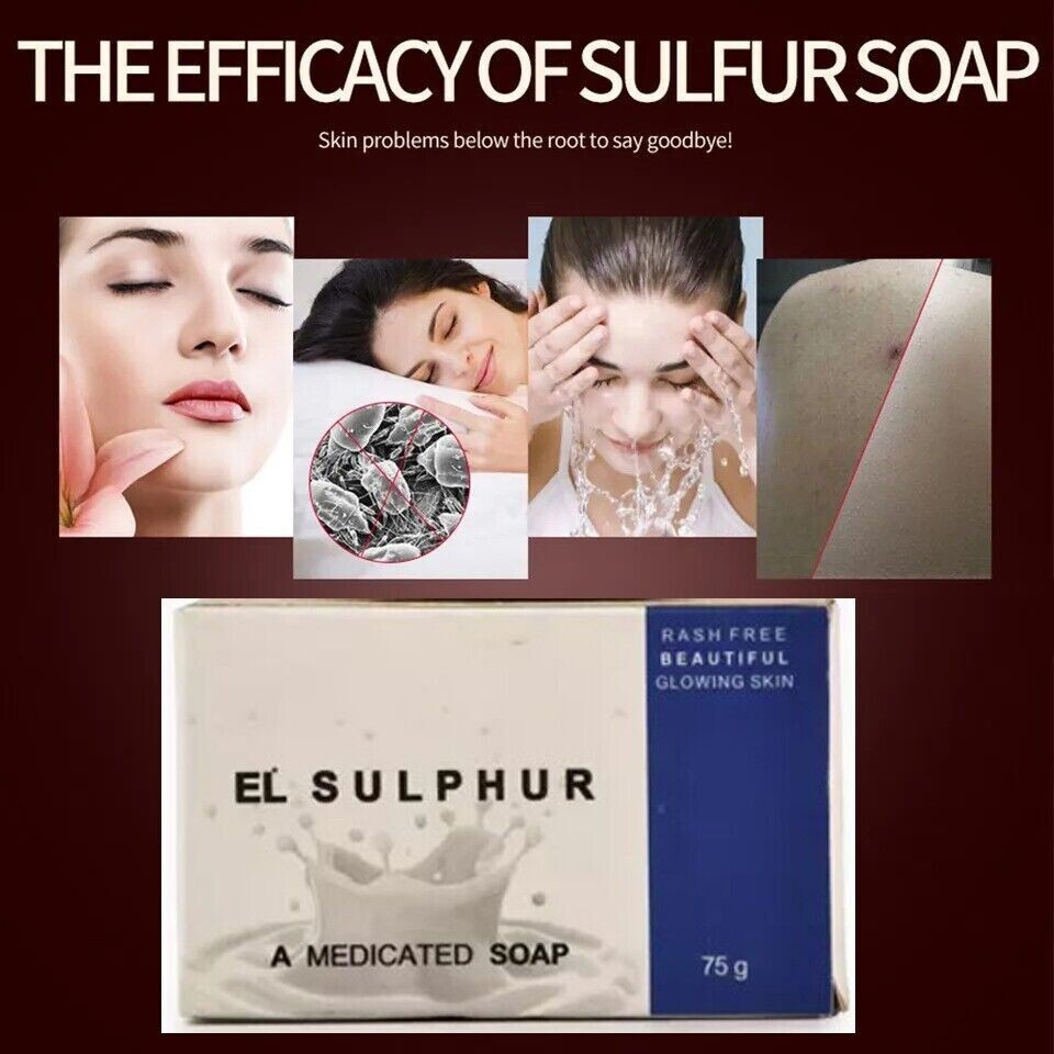Anti Fungal Sulfur Soap Mites Scabies Acne Treatment Itching Body Bath ...