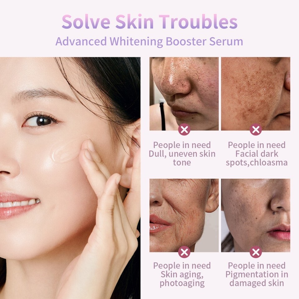 2x20ml SKINTIFIC SymWhite 377 Dark Spot Serum With Niacinamide ...
