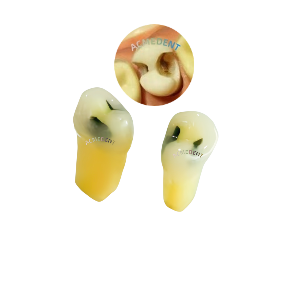 10Pcs Fit Frasaco AG-3 ZKN Dental Cavity Teeth Model Tooth Teaching ...