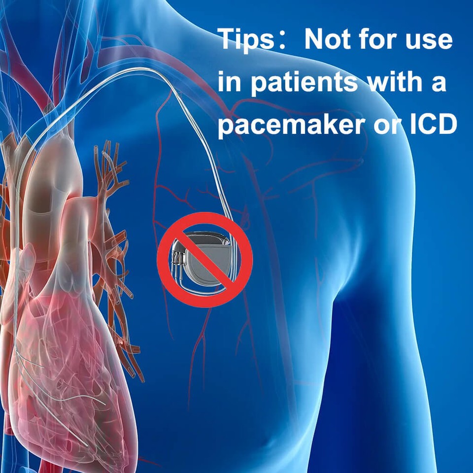 AI Holter Monitor 24 Hrs Chest Strap EKG Monitor with Free AI Analysis ...