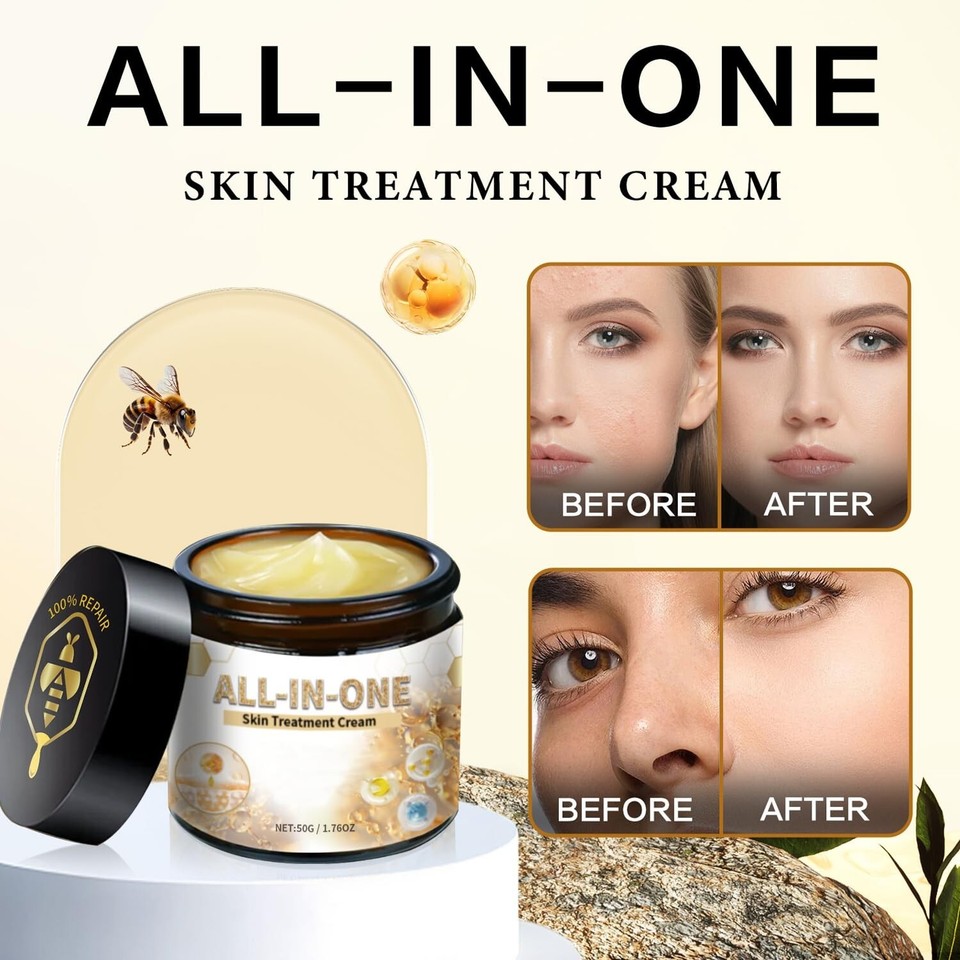 2 Pcs All-In-One Skin Cream,Bee Venom Cream, New Bee Venom Cream 50 GM ...