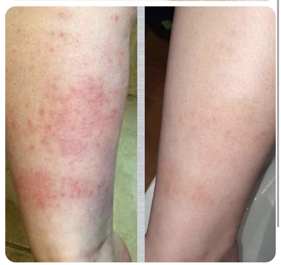 Epoch Baobab Body Butter Vanilla Cupcake🧁 Sunburn, Diaper Rash, Skin ...