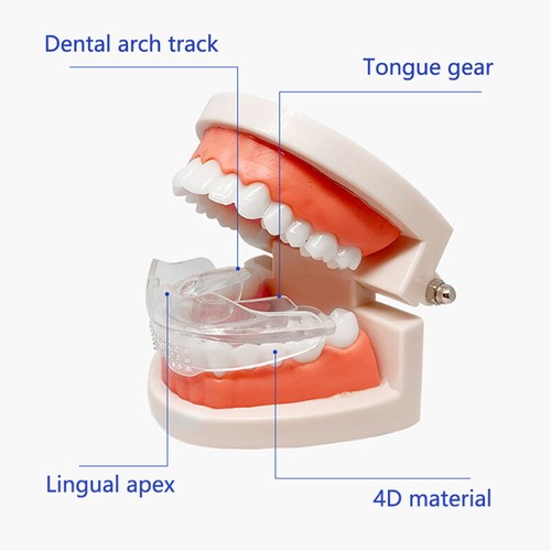 Orthodontic Braces Dental Braces Instanted Silicone Smile Teeth ...