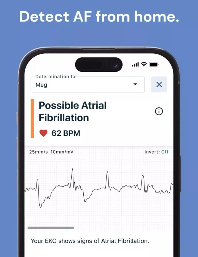 AliveCor KardiaMobile ECG EKG Heart Monitor - Smartphone compatible NEW ...