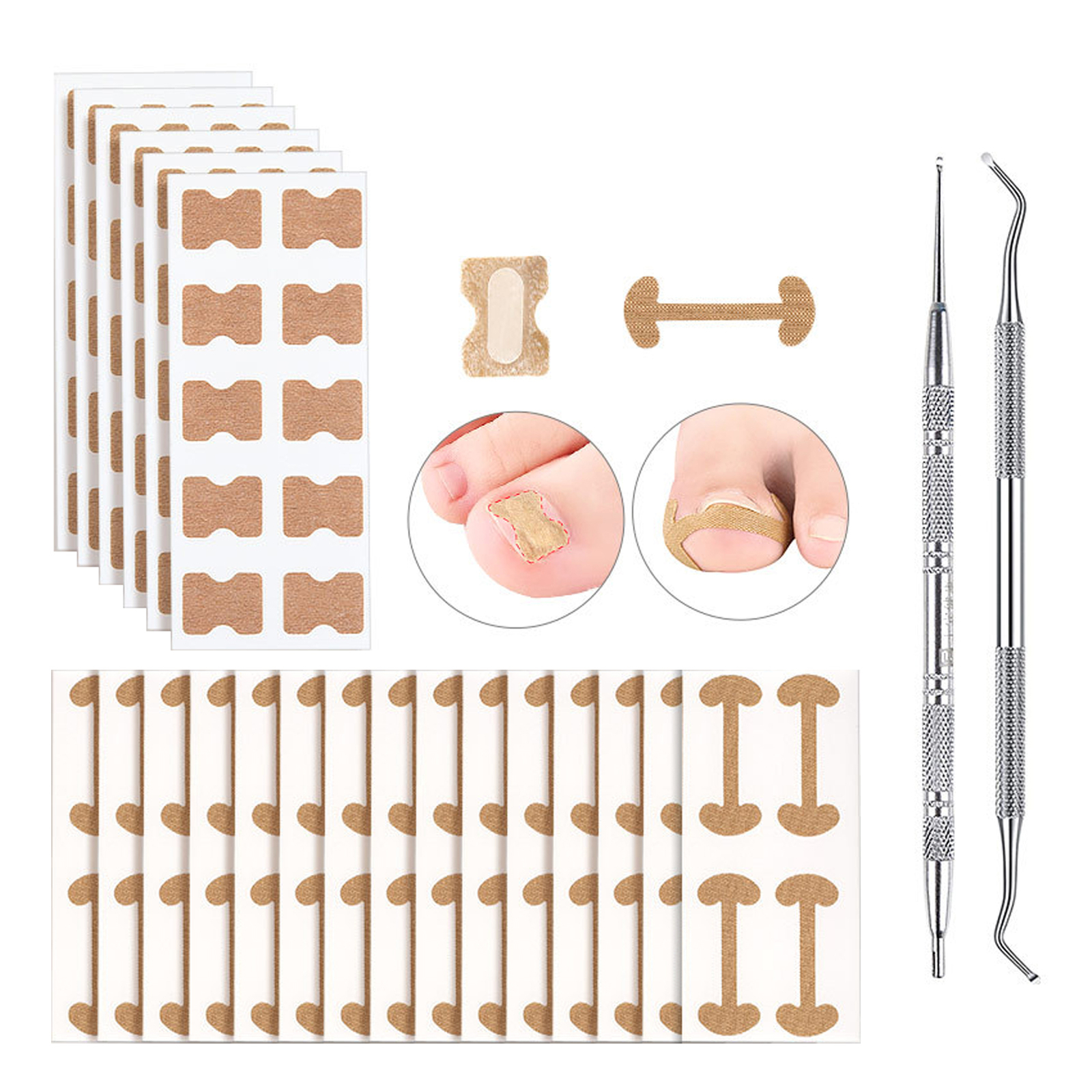 Ingrown Toenail Corrector Painless Toe Stickers Home Planing Tool ...