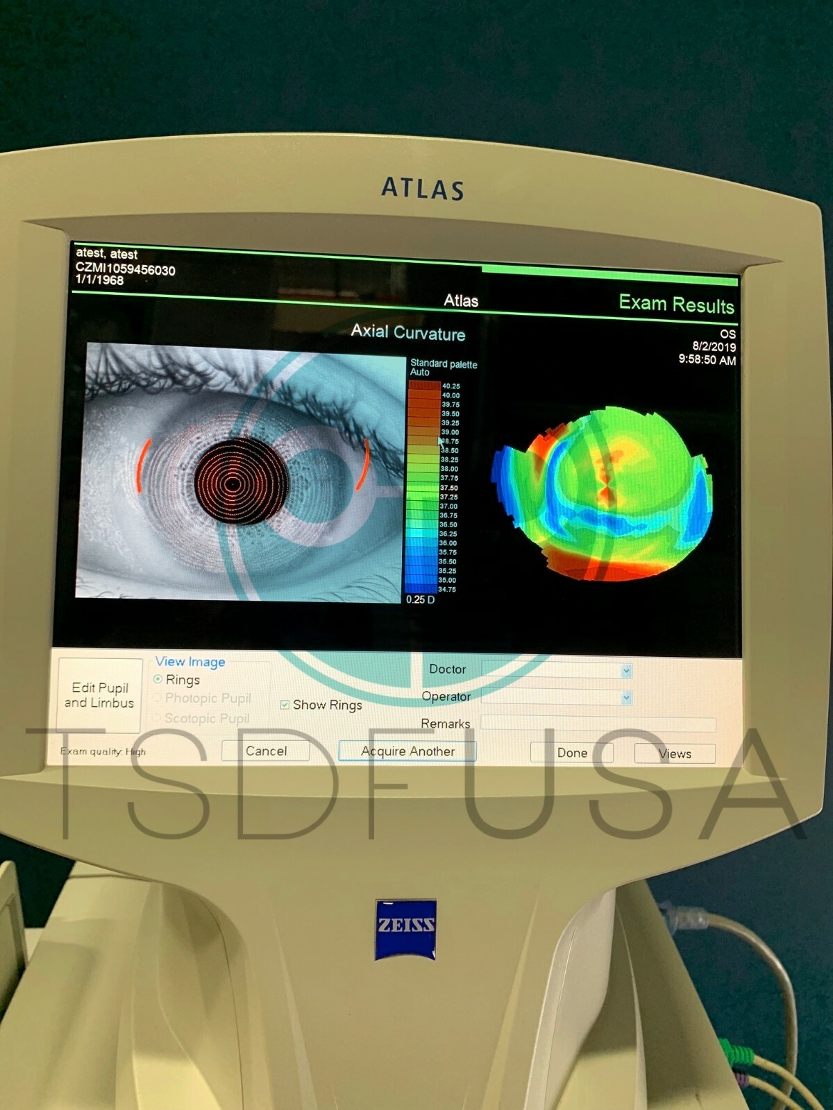 Zeiss ATLAS 9000 Corneal Topography | eBay