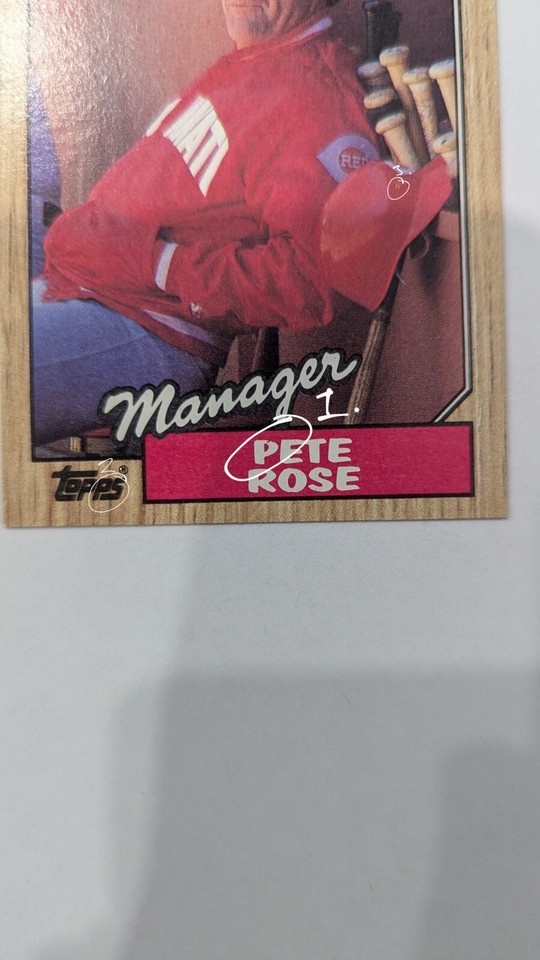 1987 Topps Pete Rose #383 ERROR CARD (3 ERRORS) - SEE PICTURES | eBay