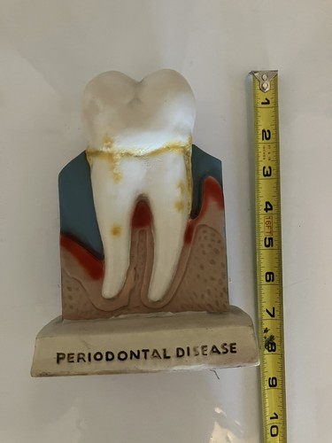 Vintage Giant tooth teeth brushing dental education Periodontal Display ...