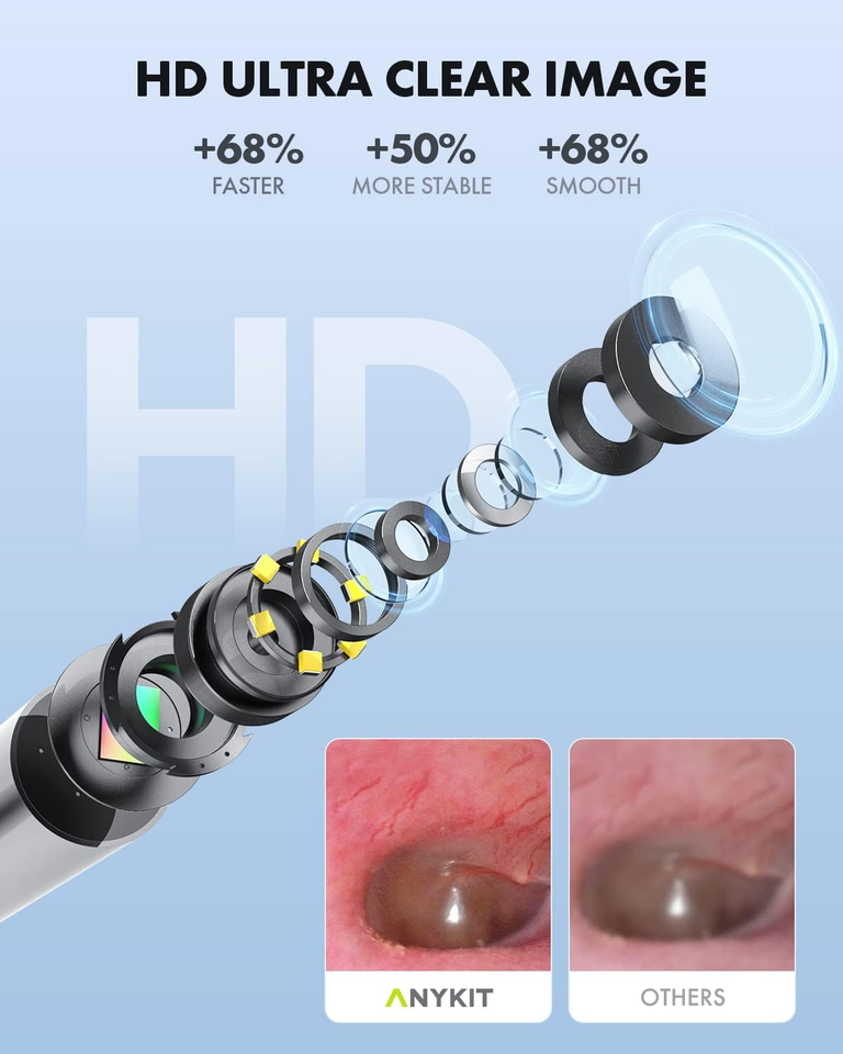 Wireless Otoscope Ear Camera with Dual View, 3.9Mm 720PHD Wifi Ear ...