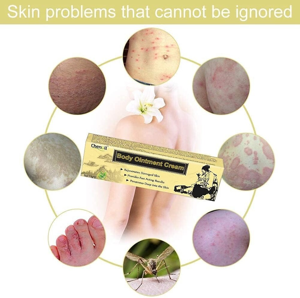 2 Crema Para Dermatitis Eczema Psoriasis Para Comezon Picazon Ronchas ...