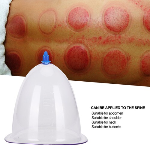 Extra Large PC Single Cupping Cup Health Care Body Massage Tool JFF | eBay