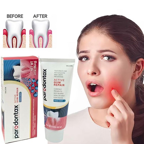 Periodontitis Repair Toothpaste,effectively Relieves Gum Bleeding and ...