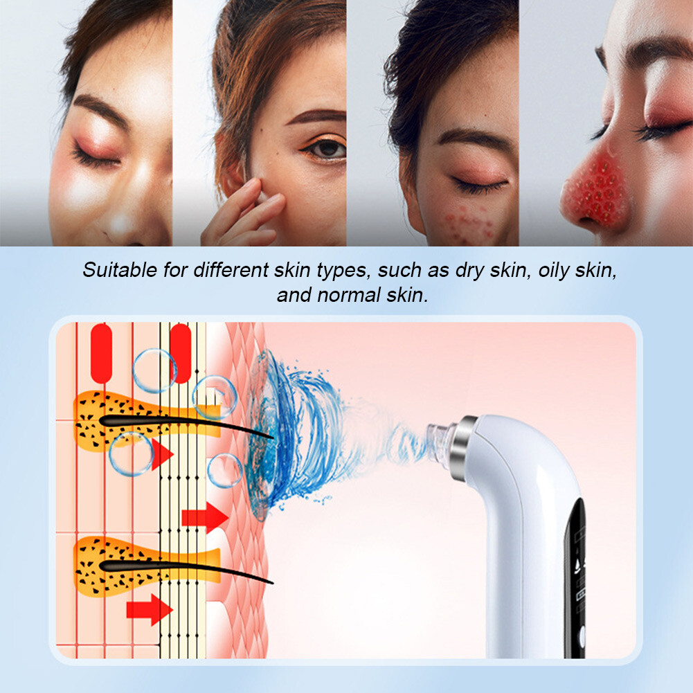 Vacuum Suction Pore Acne Water Cycle Electric Blackhead Remover ABS ...