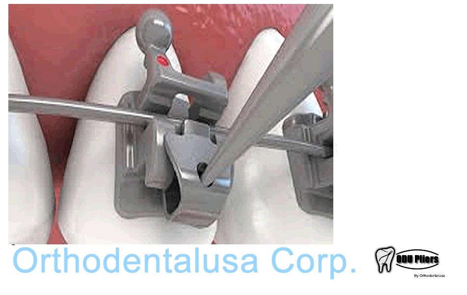 BRACKET CASE SELF LIGATING ROTH .022 PAK/20 / MORELLI / 1014900 / SLI ...