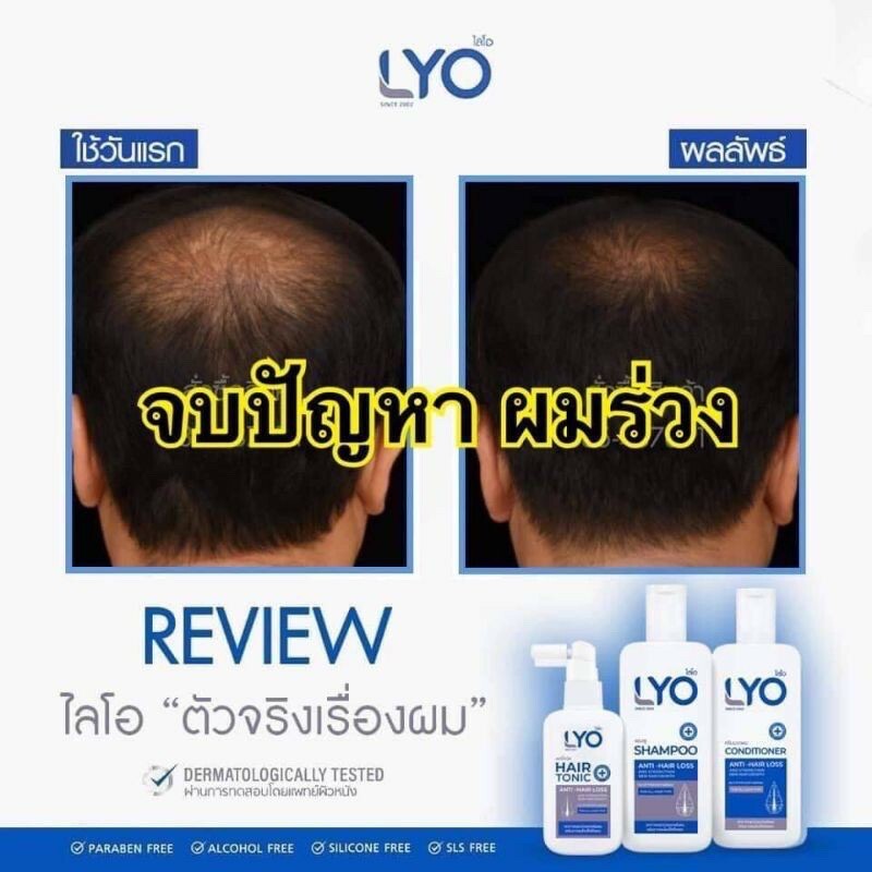 6x LYO Hair Lotion Tonic Shampoo Conditioner Growth Hair Beard Prevent ...