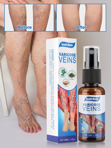 2Pcs VeinFix Varicose Treatment Spray Veinhealing Varicose Veins Treatment Spray | eBay