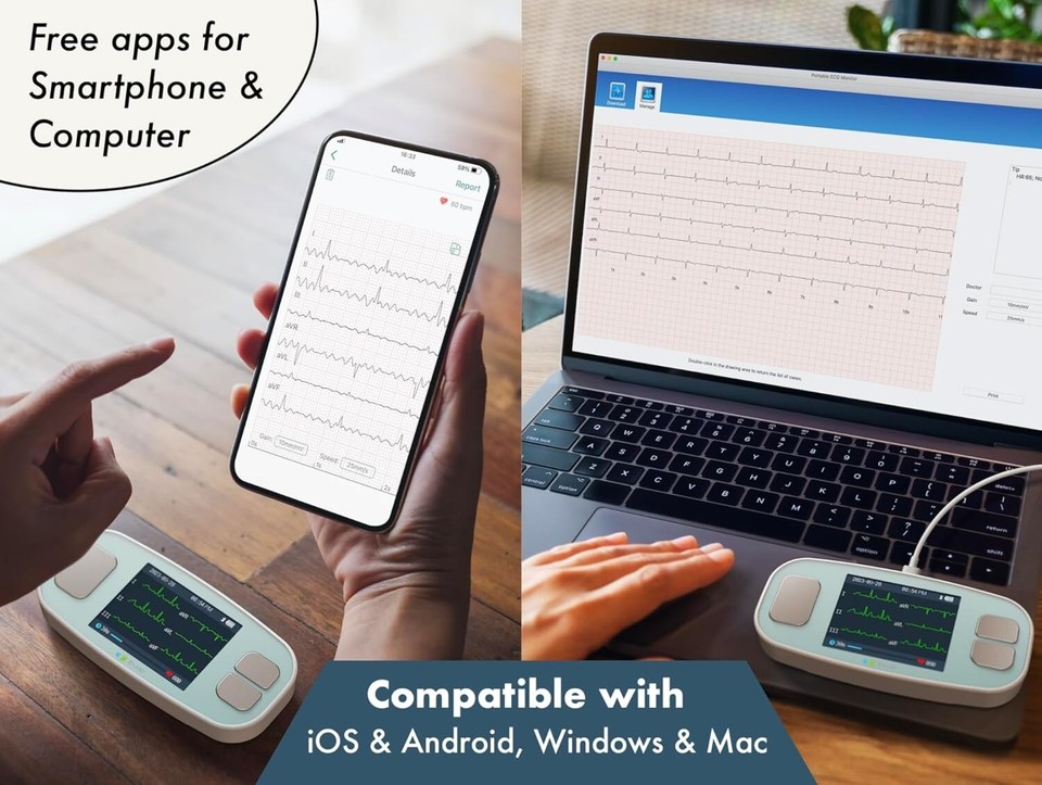 EMAY 6L Portable ECG Monitor - Record ECG & Heart Rate in 6 Channels | eBay