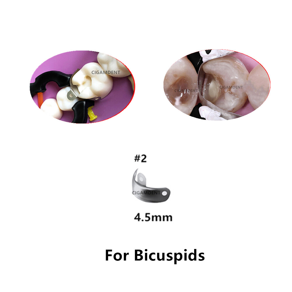 Automatrix Dental Matrix Band Ring Sectional Contoured Matrice ...