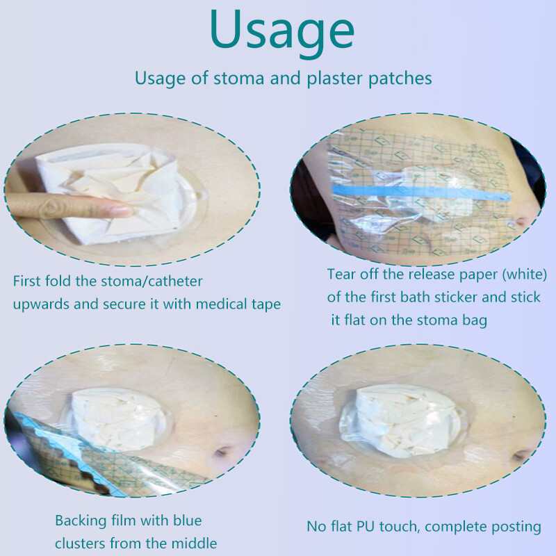 Ostomy Shower Cover Ostomy Shower PU Film Ostomy Bag Protector ...