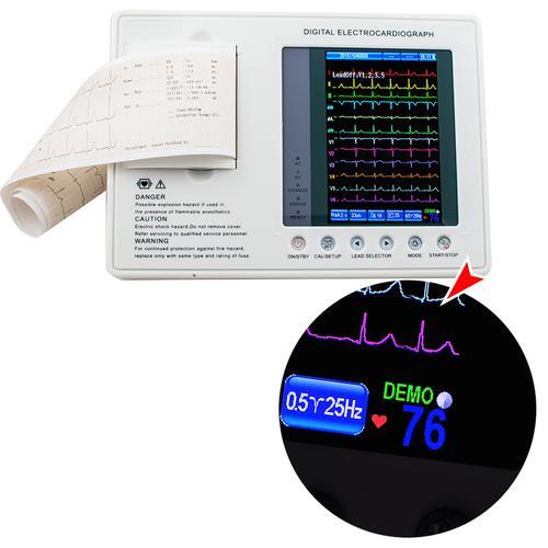 Advanced 12-Lead Color Screen ECG EKG Machine for Accurate Medical ...