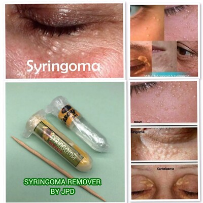Syringoma Remover by JPD - 100% Safe Effective - 2ml - With Free Oil | eBay