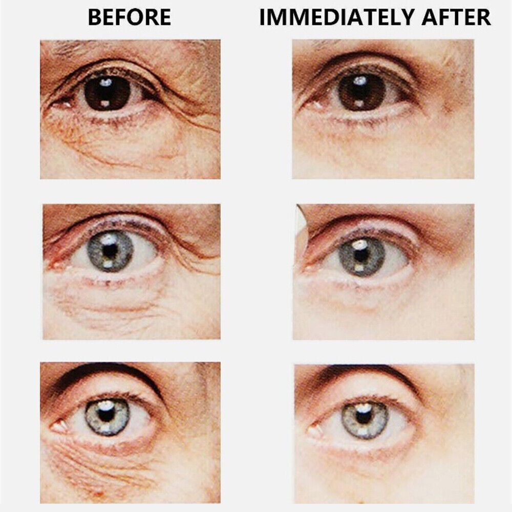 Peter Thomas Roth Instant Firmx Eye Temporary Eye Tightener 3.4 fl. oz ...