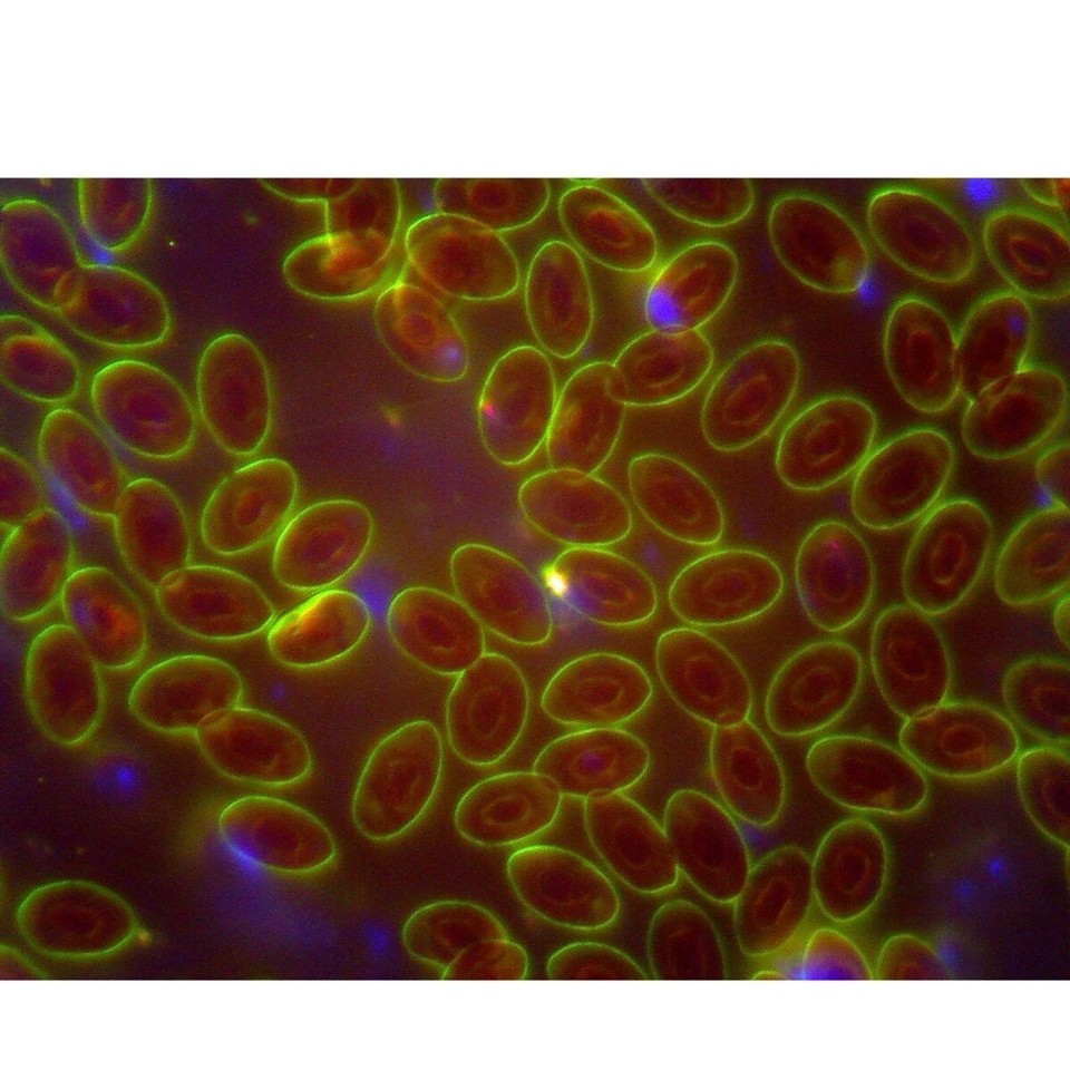 OMAX 40X-2500X USB3 5MP Darkfield Lab Trinocular LED Microscope for ...