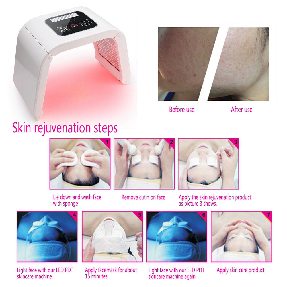 PDT 4Colors LED Light Photodynamic Facial Skin Care Rejuvenation Photon ...