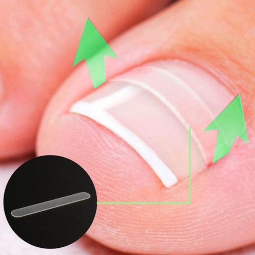10 pieces/set of toenail correction patch bracket elastic patch nail ...