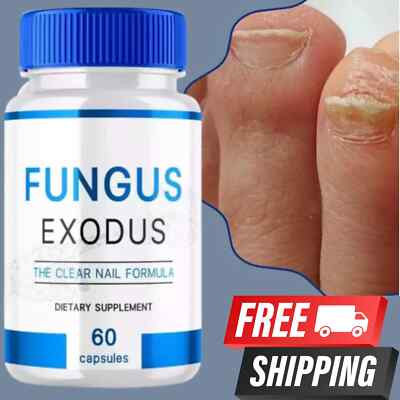 Fungus Exodus Pills to Combat Toenail Fungus and Nail Health 60 ...