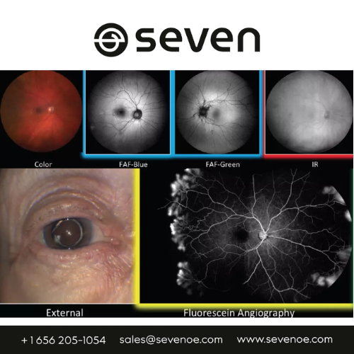 Zeiss Clarus 700 Fundus Camera | eBay