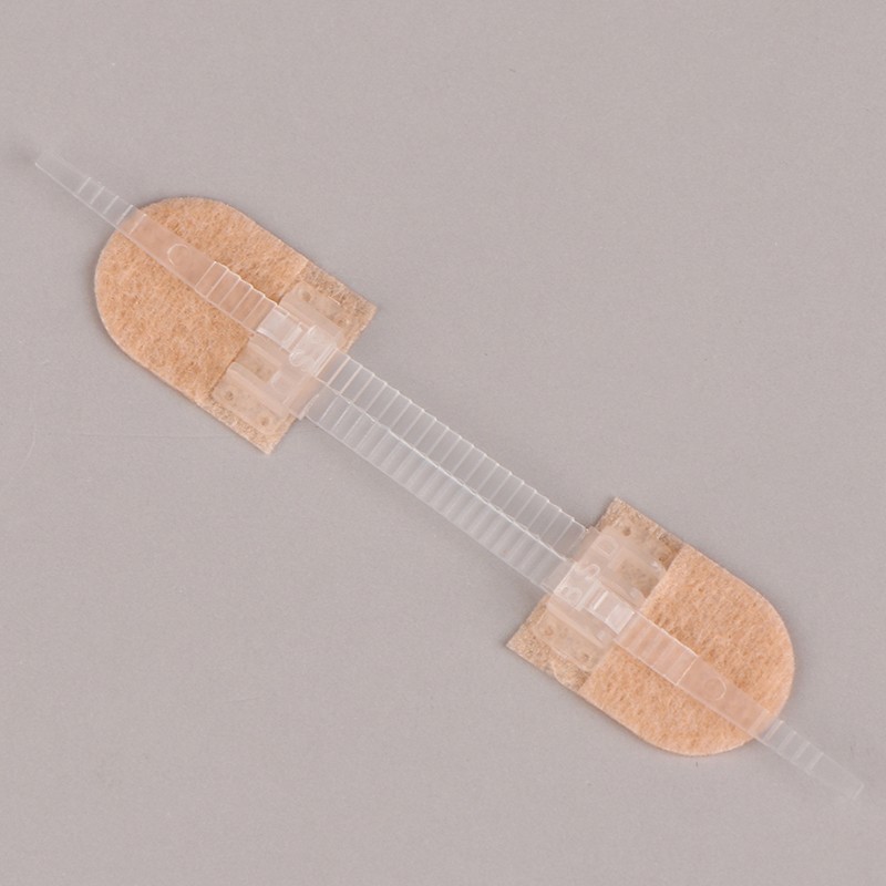 Emergency Wound Closures Pull Type Bandage Laceration Repair Zip ...
