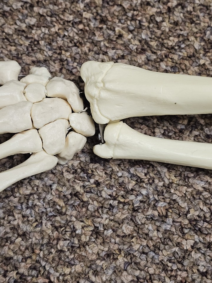 SCIENTIFIC Human Upper Limb Skeleton Anatomical Model, Life Size Arm ...