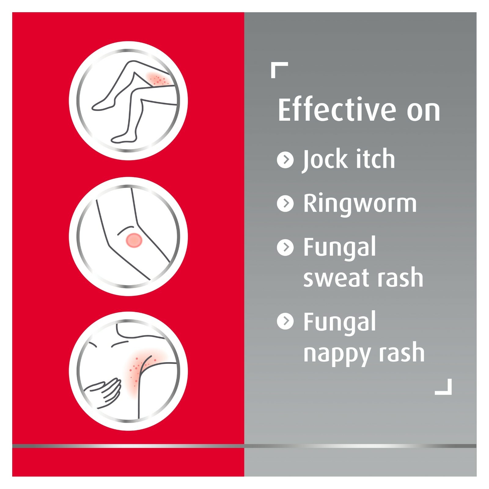 Canesten 1% Antifungal Cream, Athletes Foot, Sweat Rash, Ring Worm, 20g ...